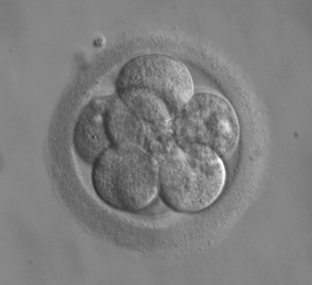 Embryonic Stem Cell Research Is Necessary | RealClearScience