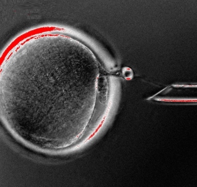 #1. Human Embryos Cloned | RealClearScience