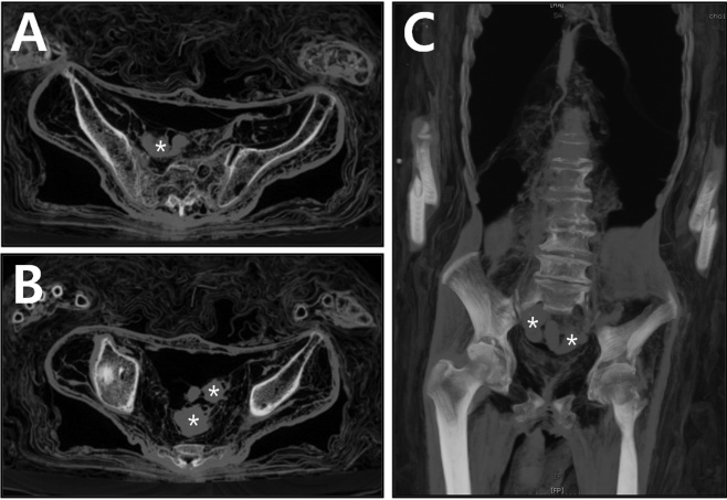 A Mummy's Feces Reveals His Final Meals | RealClearScience